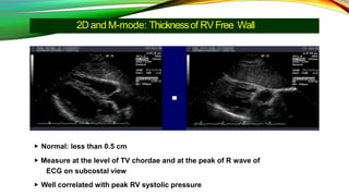 Echo assesment of rv function | PPTX | Heart and Cardiovascular ...