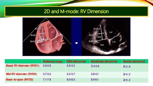 Echo assesmentof rv function