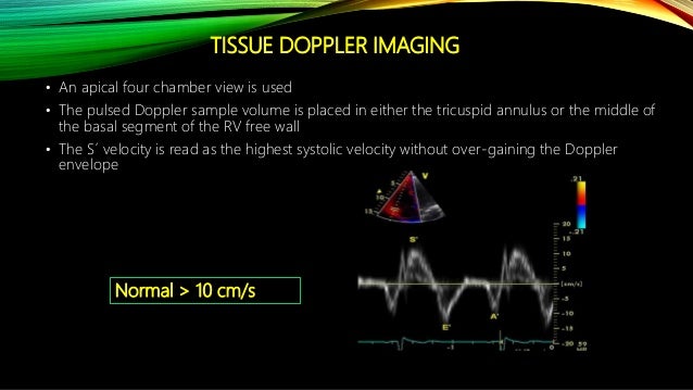 Echo assesmentof rv function