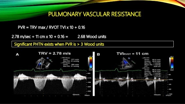 Echo assesmentof rv function