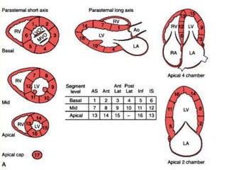 Echocardiographic assesment of systolic and diastolic dysfunction | PPTX