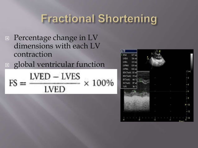 Echocardiographic assesment of systolic and diastolic dysfunction | PPTX