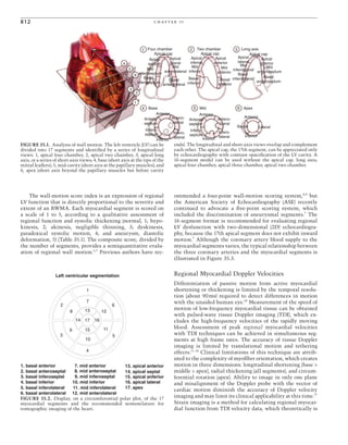Echo assessment of coronary artery disease | PDF