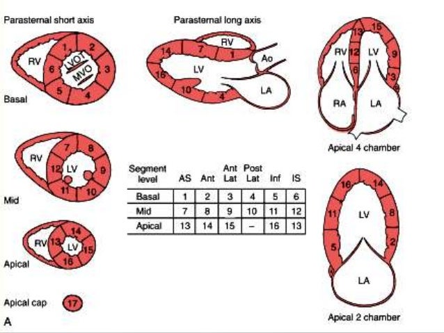 Echo assessment of lv systolic function and swma