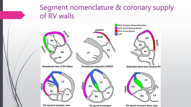 Echo assessment of RV function | PPTX | Heart and Cardiovascular ...