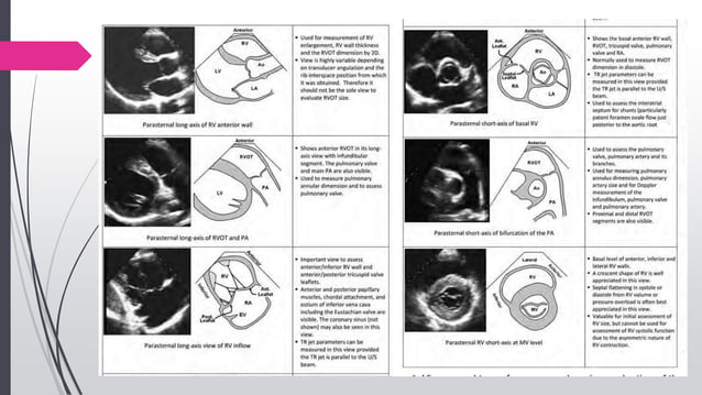 Echo assessment of RV function | PPTX | Heart and Cardiovascular ...
