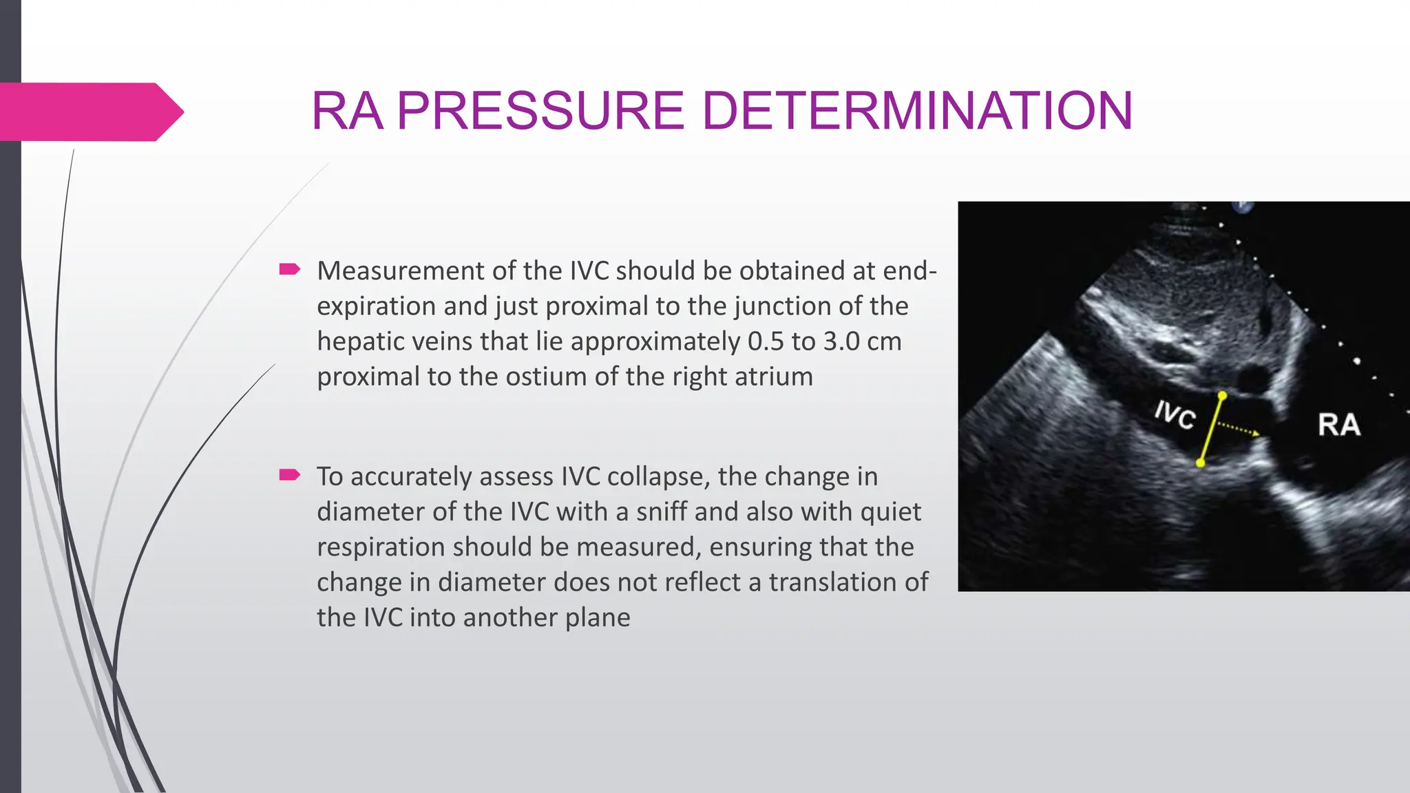 echo assessment RV function by dr amit (1).pptx