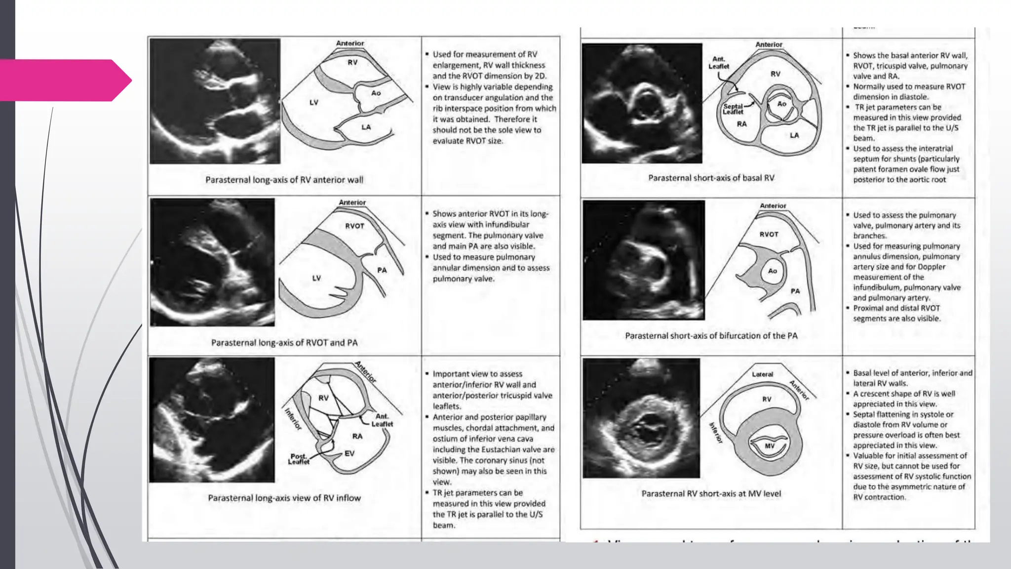 echo assessment RV function by dr amit (1).pptx
