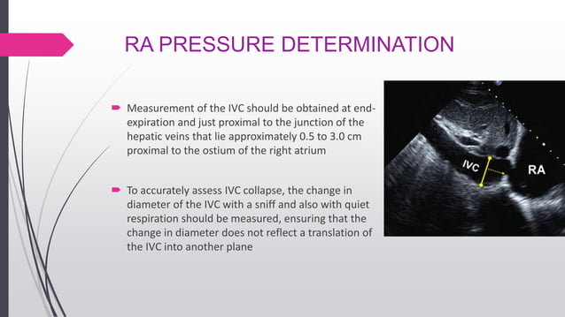 echo assessment RV function by dr amit (1).pptx