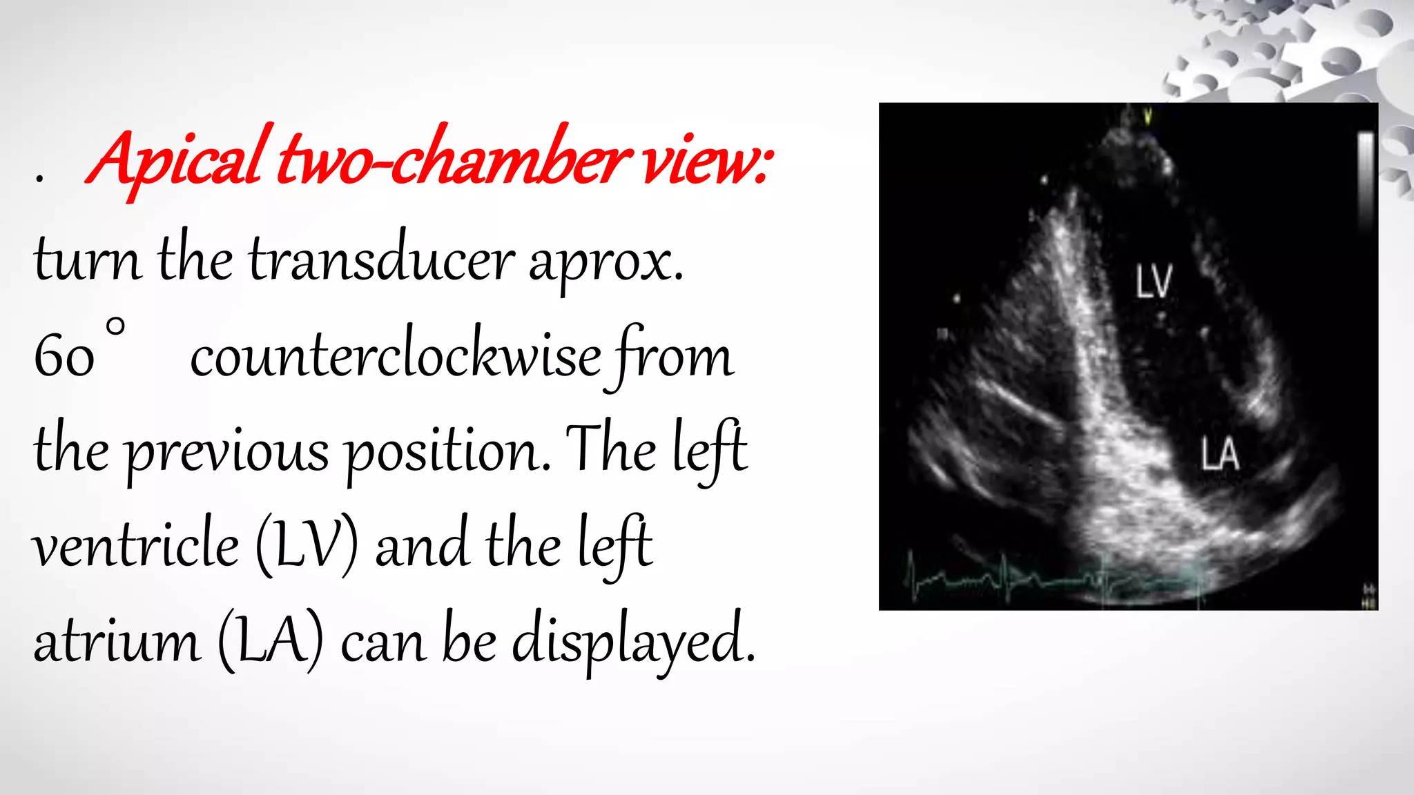Echobasics | PPTX | Heart and Cardiovascular Diseases | Diseases and ...