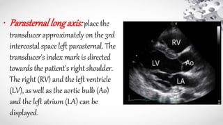Echobasics | PPTX | Heart and Cardiovascular Diseases | Diseases and ...