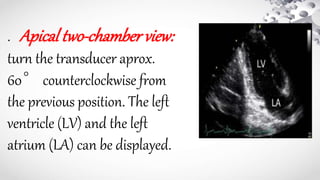 Echobasics | PPTX | Heart and Cardiovascular Diseases | Diseases and ...