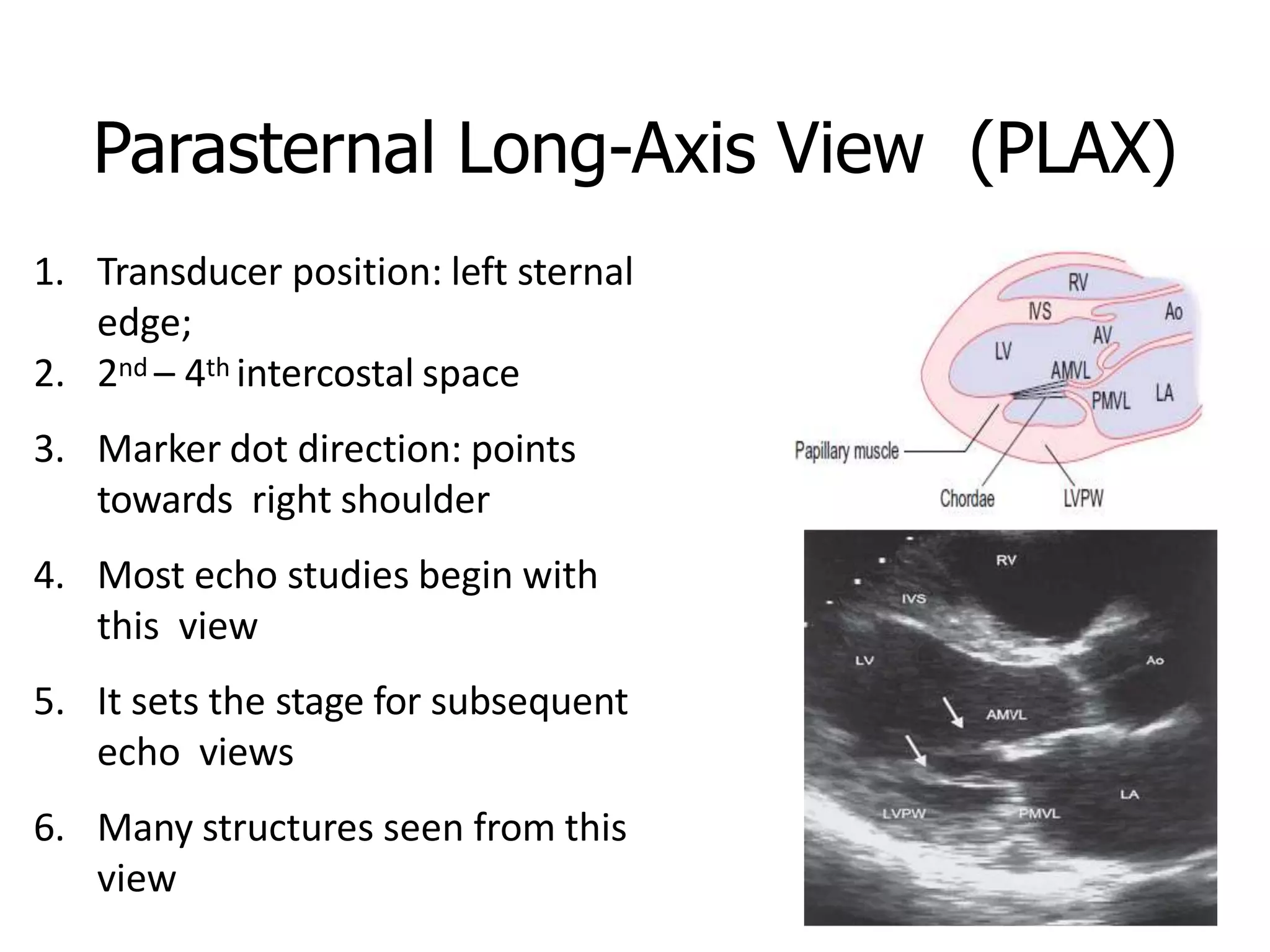 Basics of echocardiography | PDF