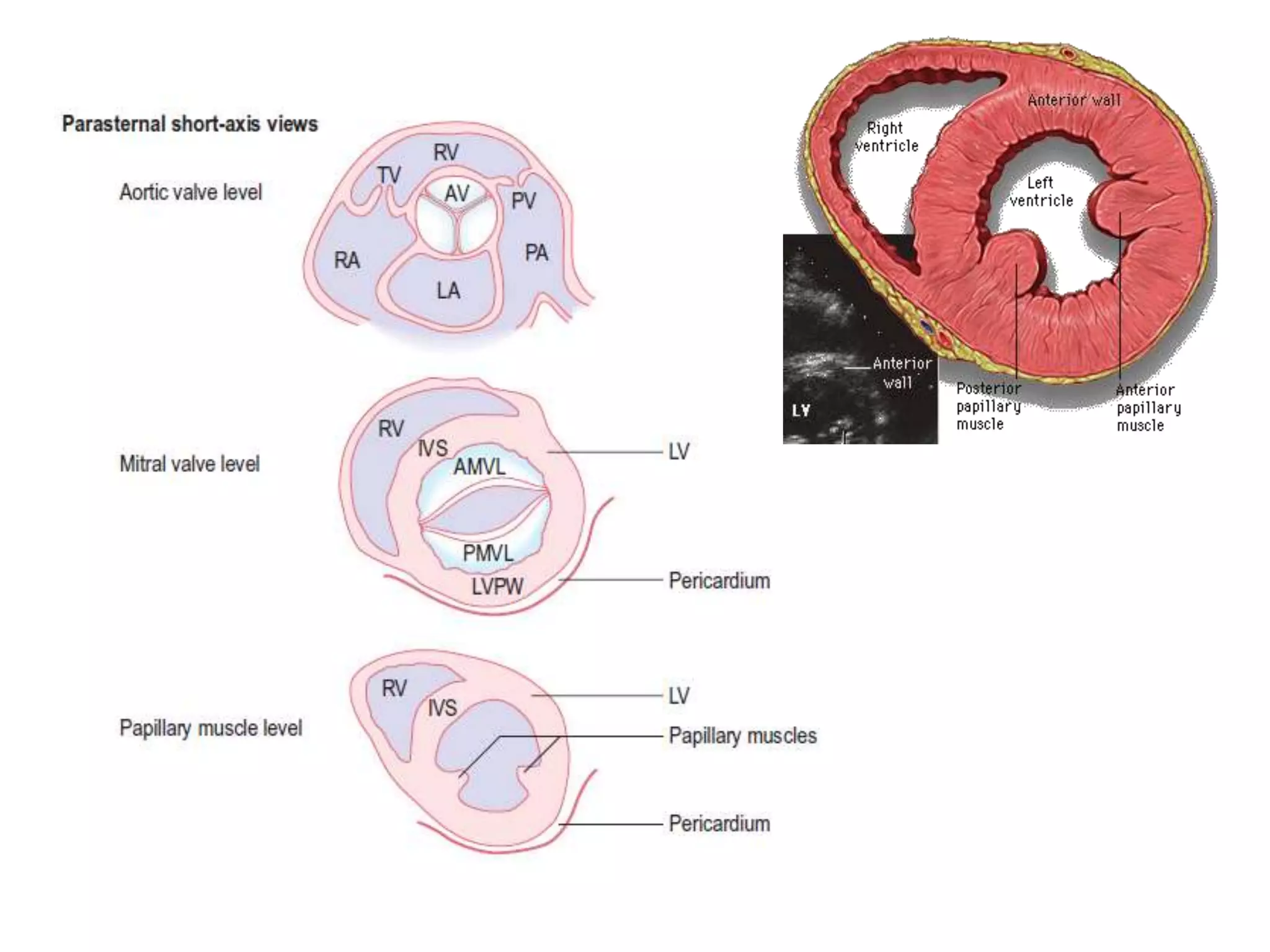 Basics of echocardiography | PDF