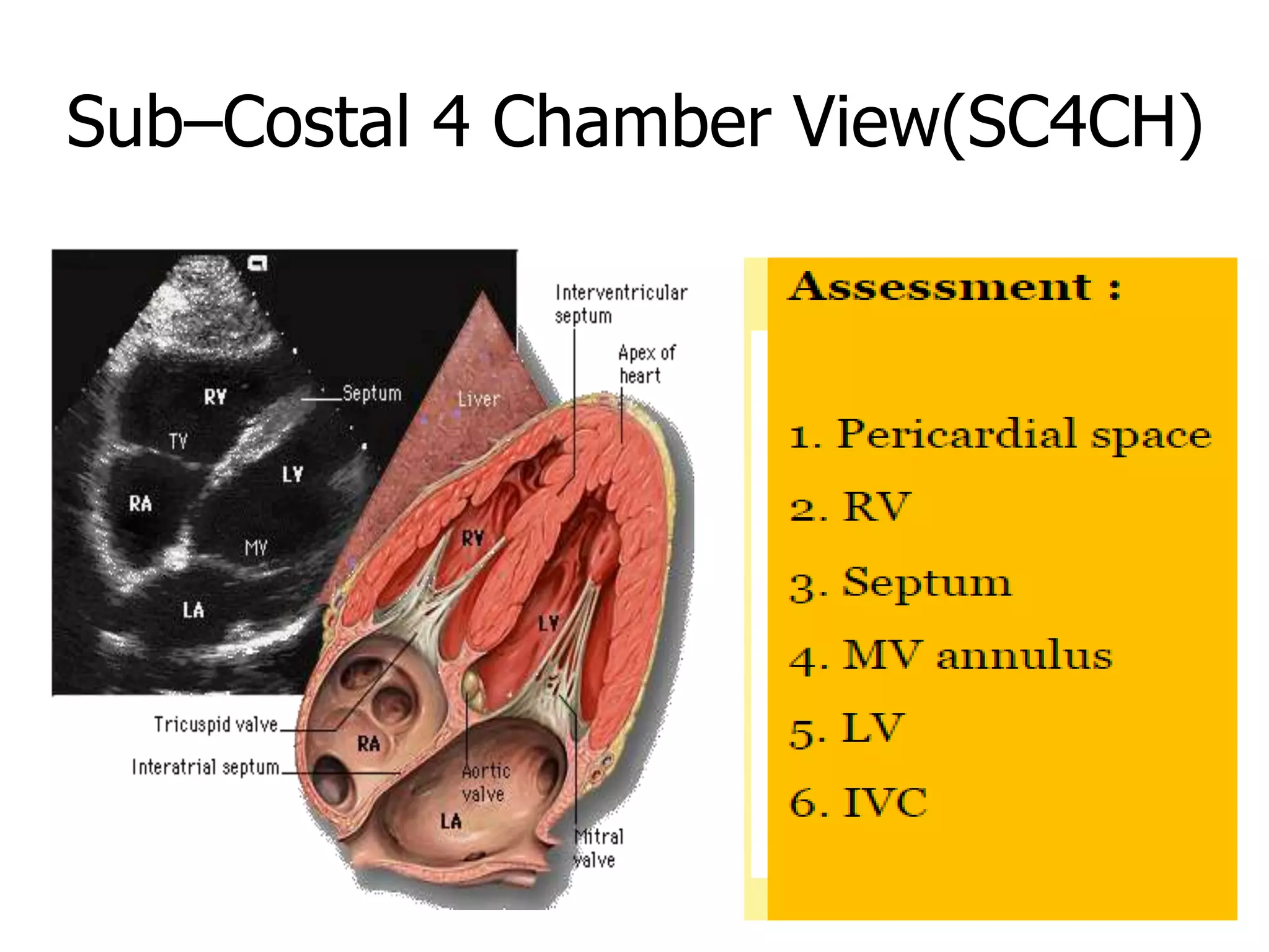 Basics of echocardiography | PDF