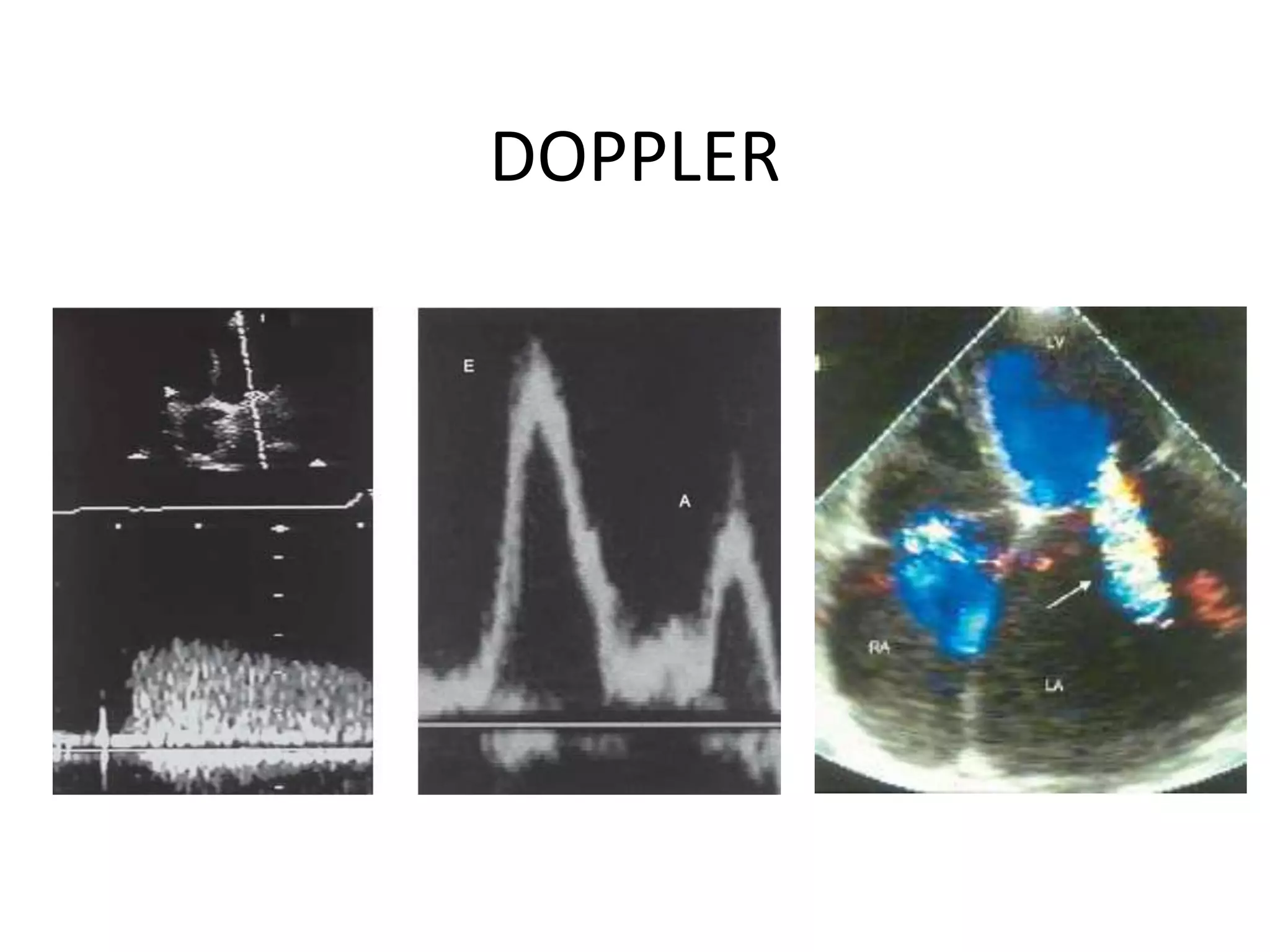 Basics of echocardiography | PDF