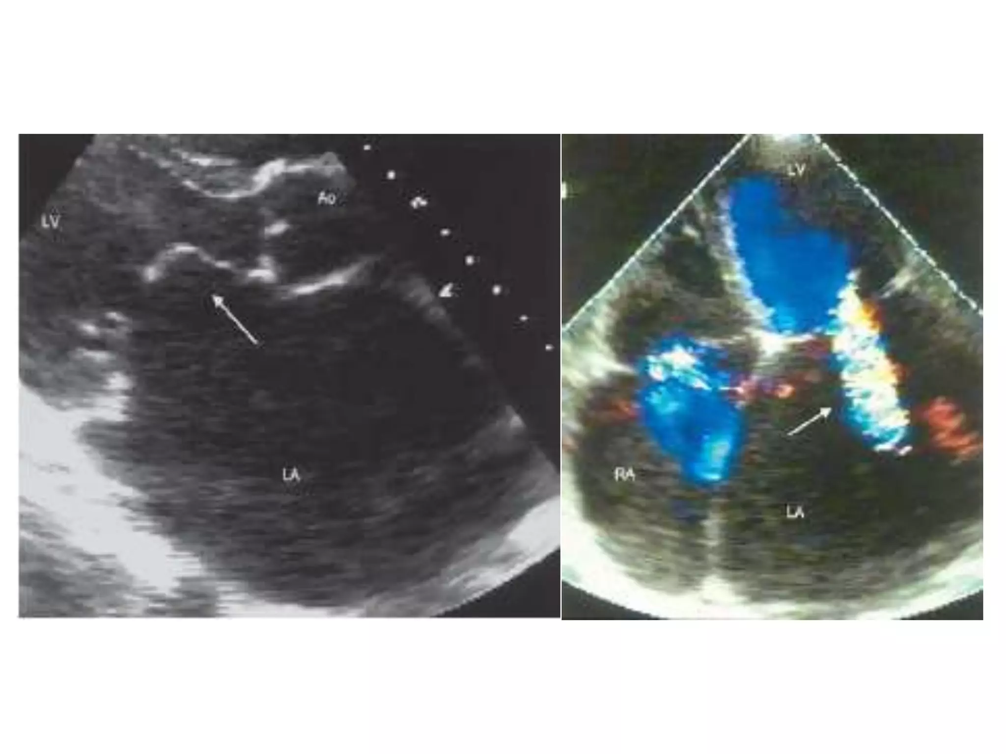 Basics of echocardiography | PDF | Digital Audio | Computer Software ...