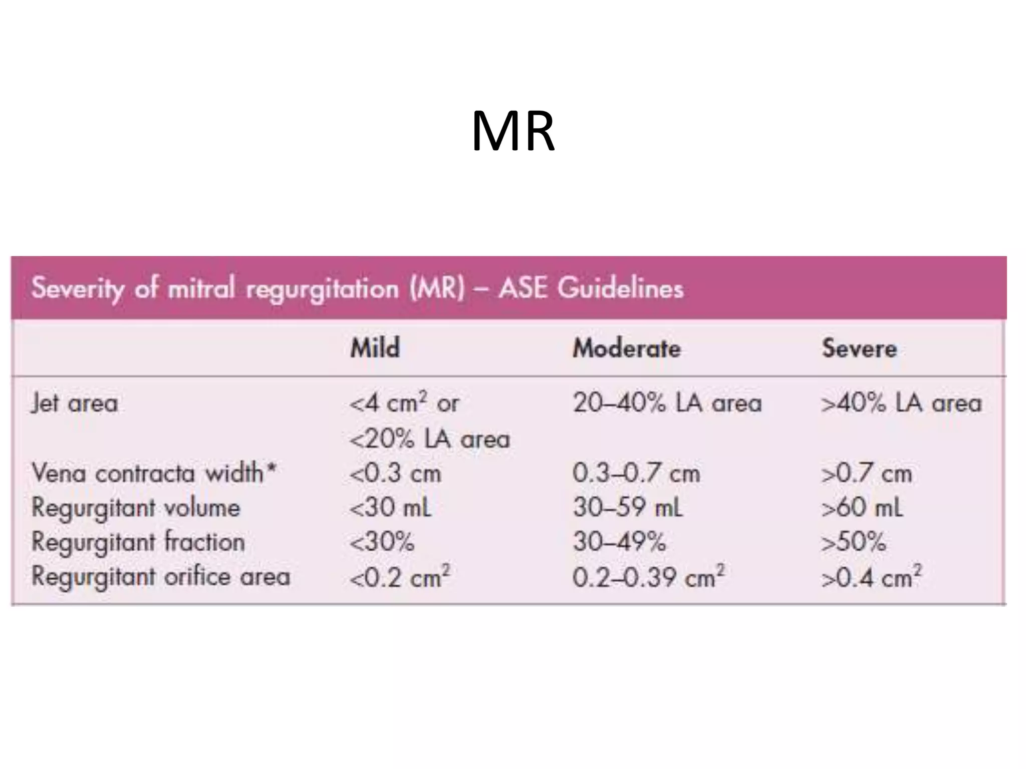 Basics of echocardiography | PDF