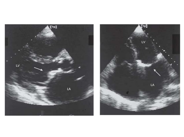 Basics of echocardiography | PDF | Digital Audio | Computer Software ...