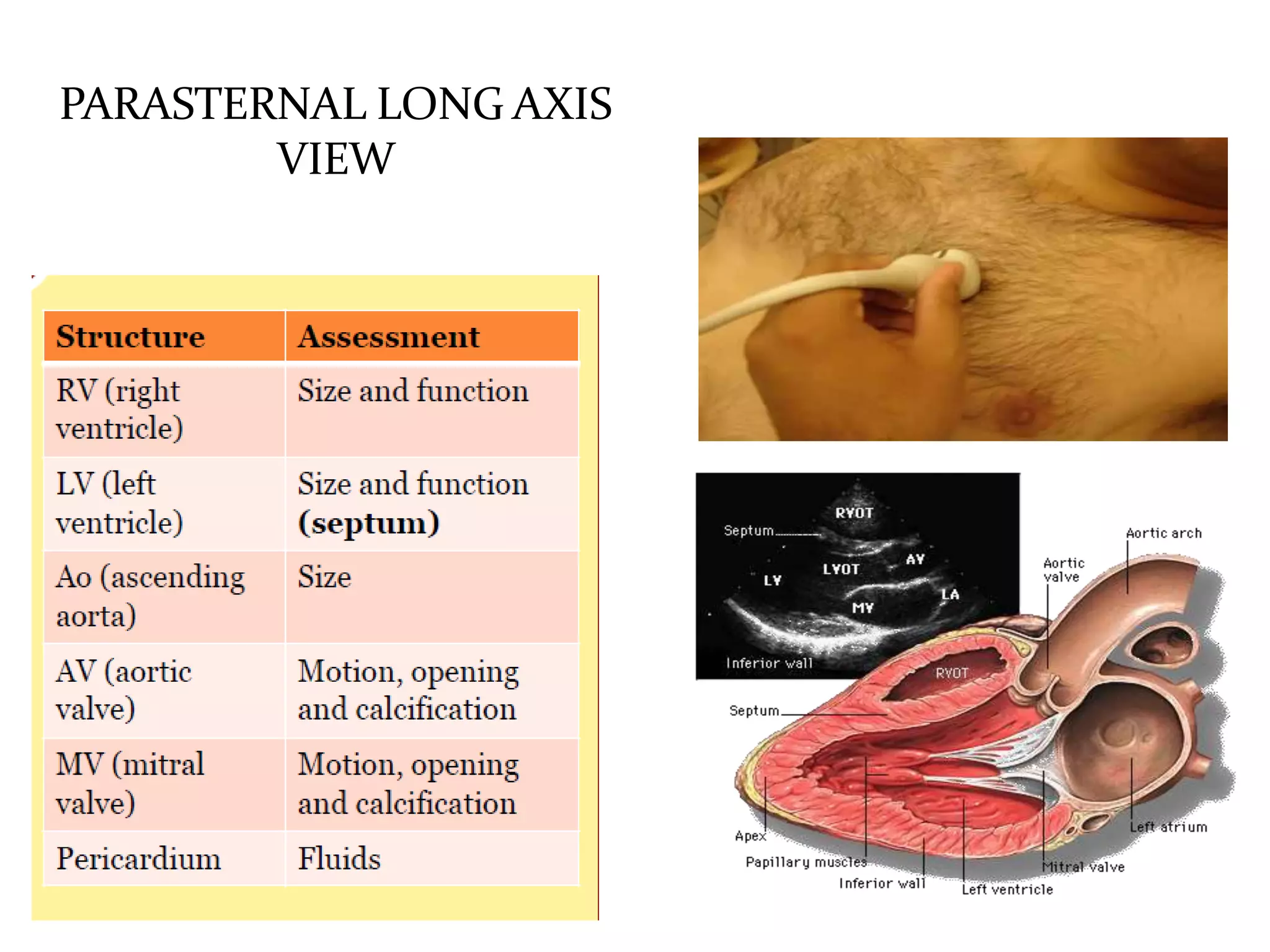 2D ECHO Basics | PPTX | Digital Audio | Computer Software and Applications