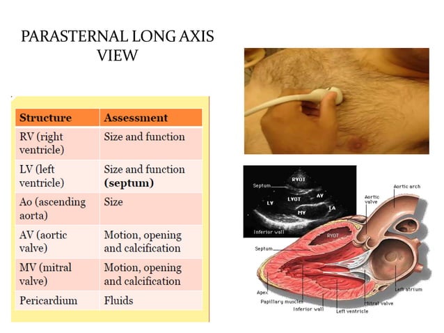 2D ECHO Basics | PPTX | Digital Audio | Computer Software and Applications