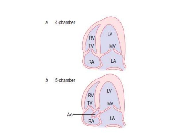 2D ECHO Basics | PPTX | Digital Audio | Computer Software and Applications