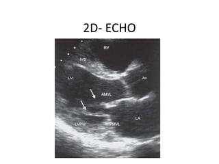 2D ECHO Basics | PPTX