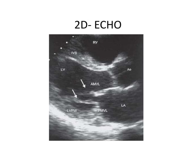 2D ECHO Basics | PPTX | Digital Audio | Computer Software and Applications