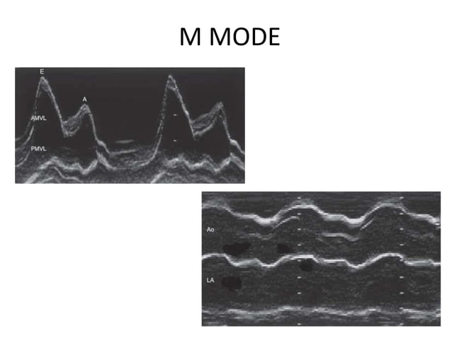 2D ECHO Basics | PPTX | Digital Audio | Computer Software and Applications