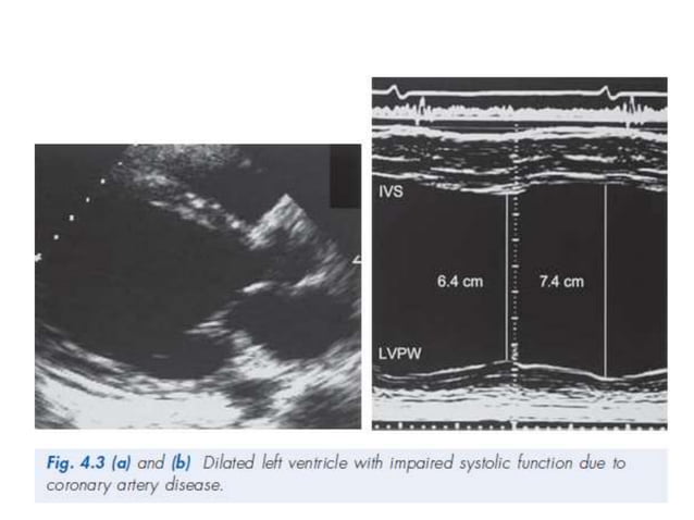 2D ECHO Basics | PPTX | Digital Audio | Computer Software and Applications