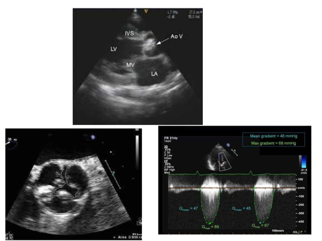 2D ECHO Basics | PPTX | Digital Audio | Computer Software and Applications