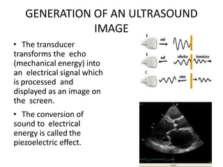2D ECHO Basics | PPTX