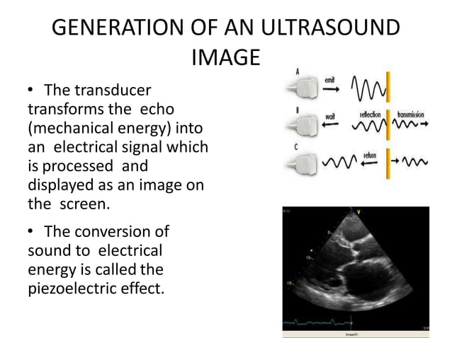 2D ECHO Basics | PPTX | Digital Audio | Computer Software and Applications
