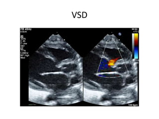 2D ECHO Basics | PPTX