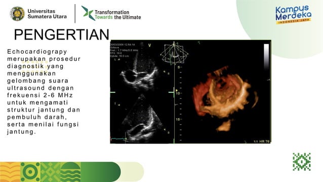 echocardiography basics from a to z.pptx