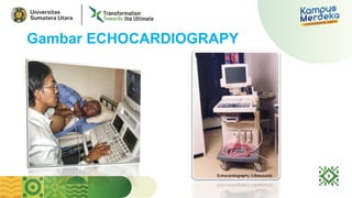 echocardiography basics from a to z.pptx