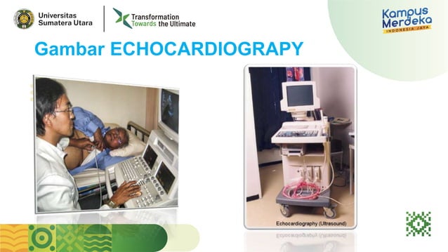 echocardiography basics from a to z.pptx