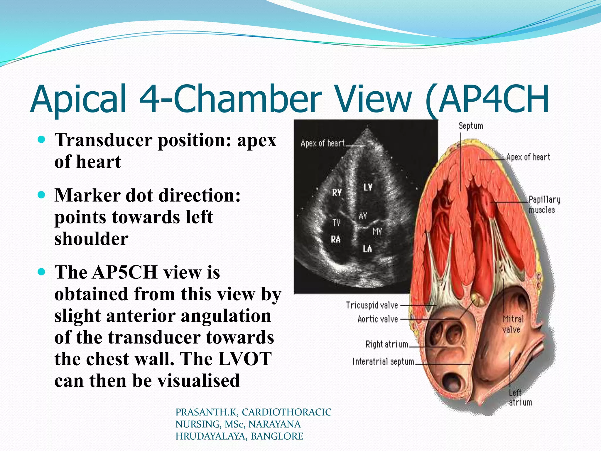 Echocardiogram Basics | PPSX
