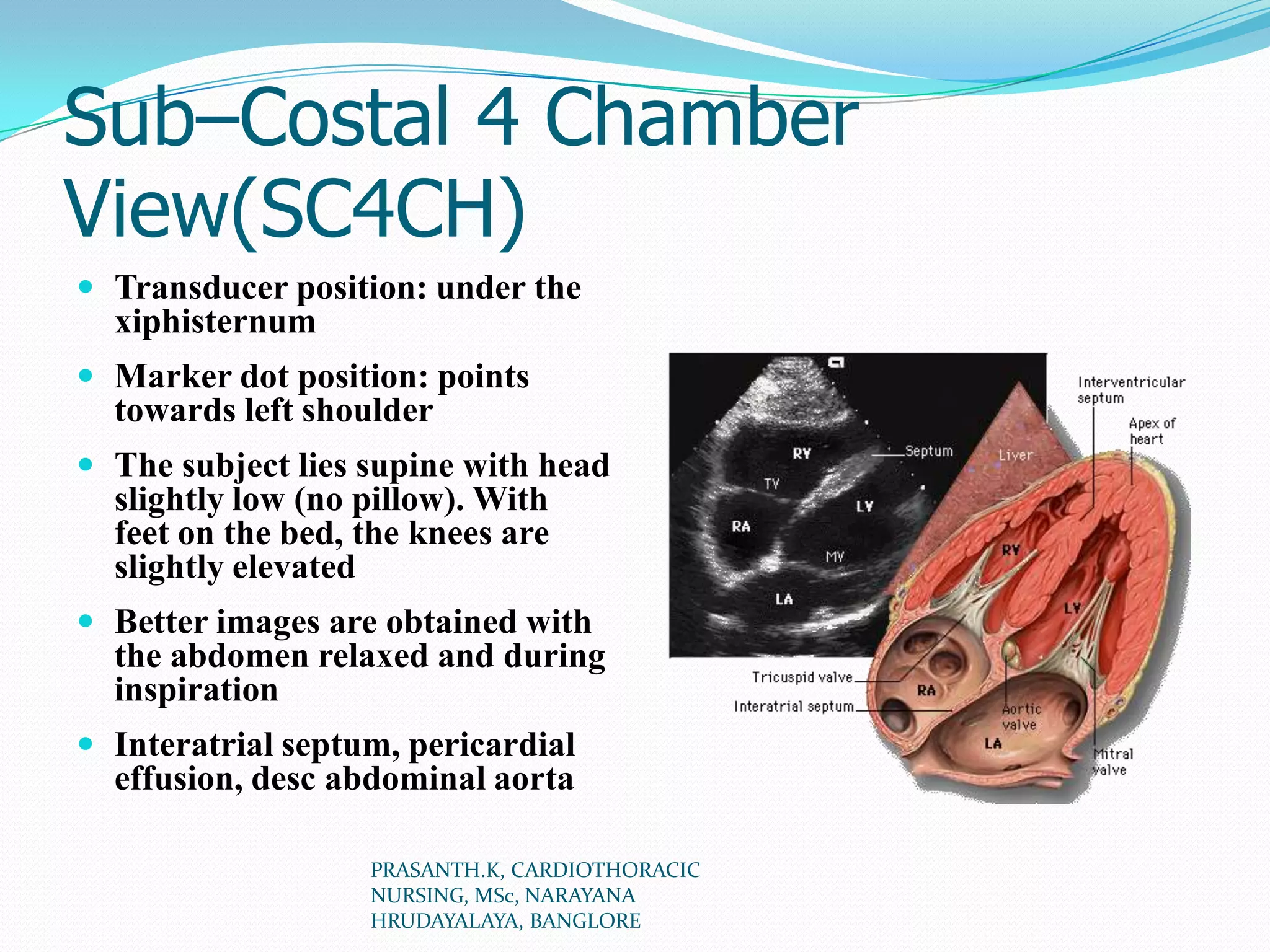 Echocardiogram Basics | PPSX