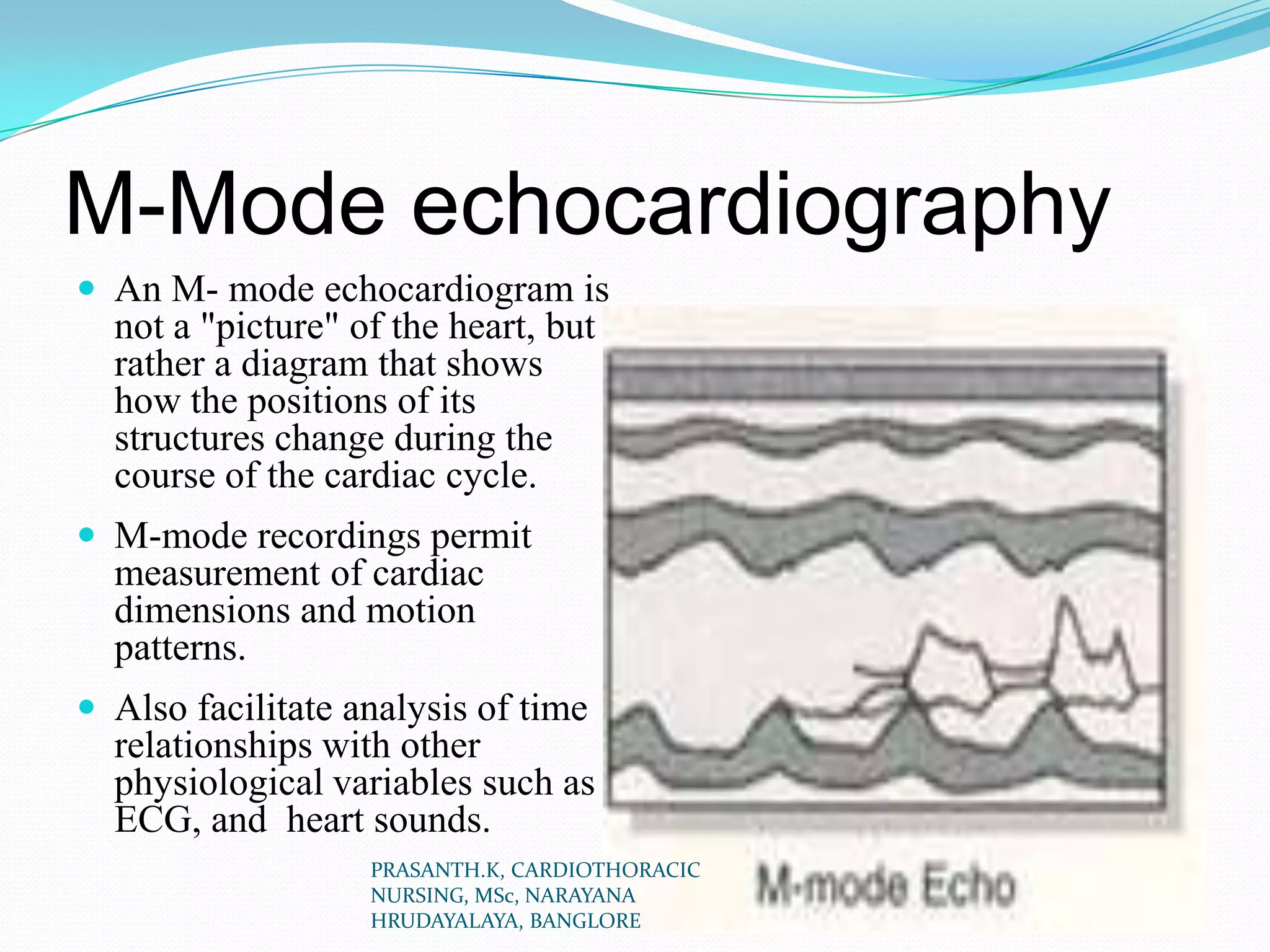 Echocardiogram Basics | PPSX