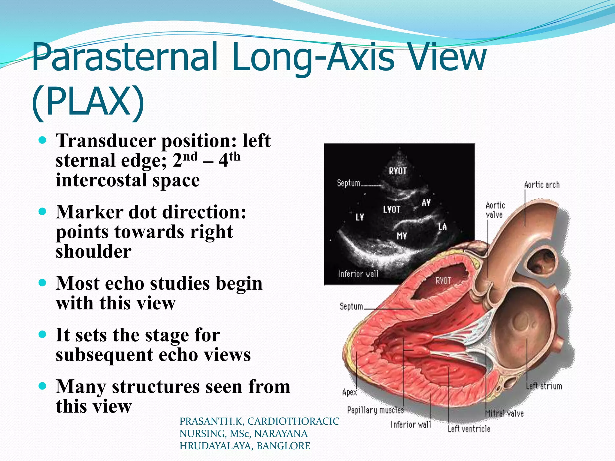 Echocardiogram Basics | PPSX