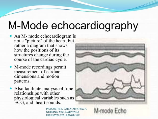 Echocardiogram Basics | PPSX | Heart and Cardiovascular Diseases ...