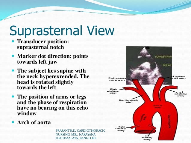 Echocardiogram Basics