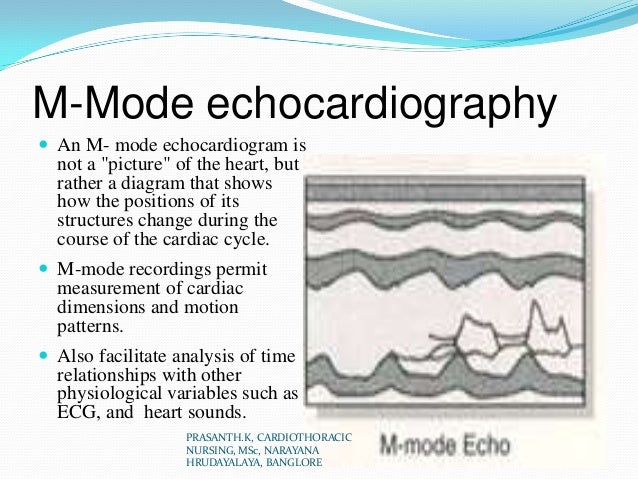 Echocardiogram Basics