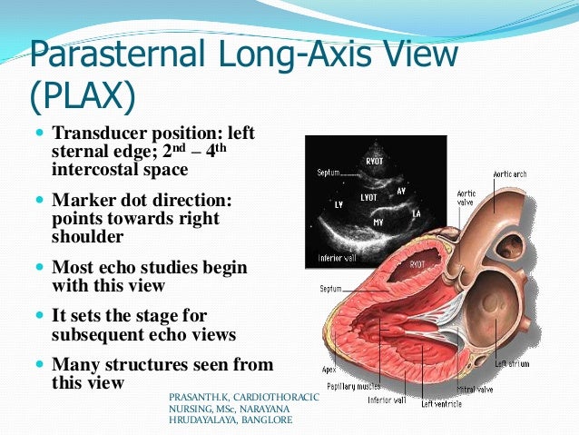 Echocardiogram Basics