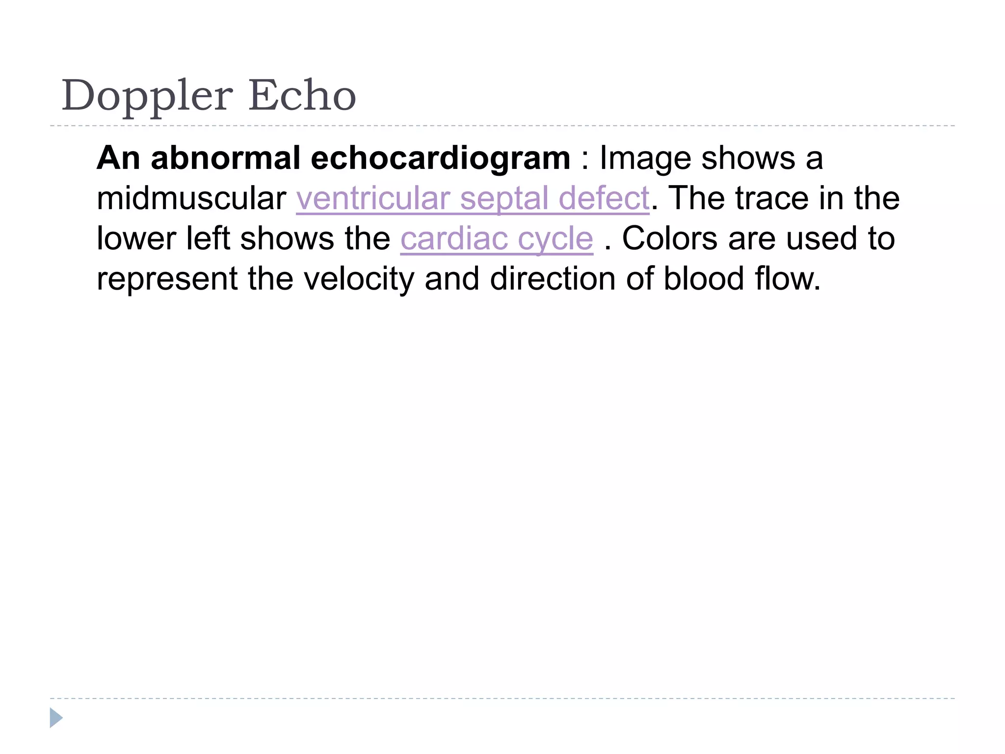Echocardiogram | PPTX