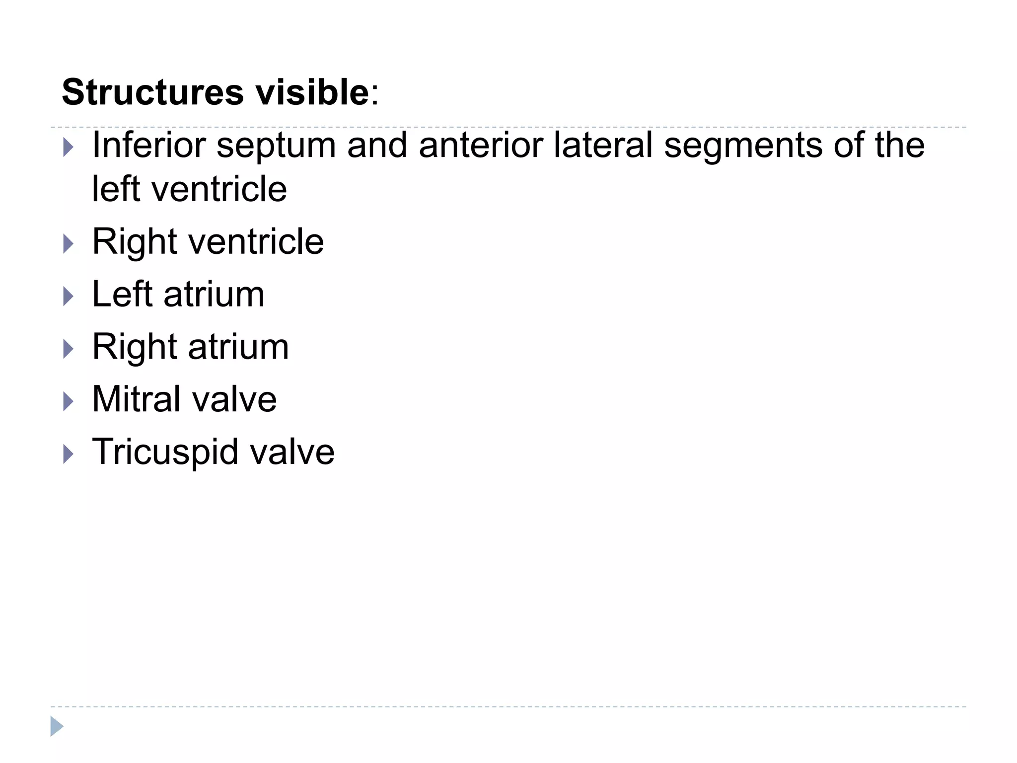 Echocardiogram | PPTX