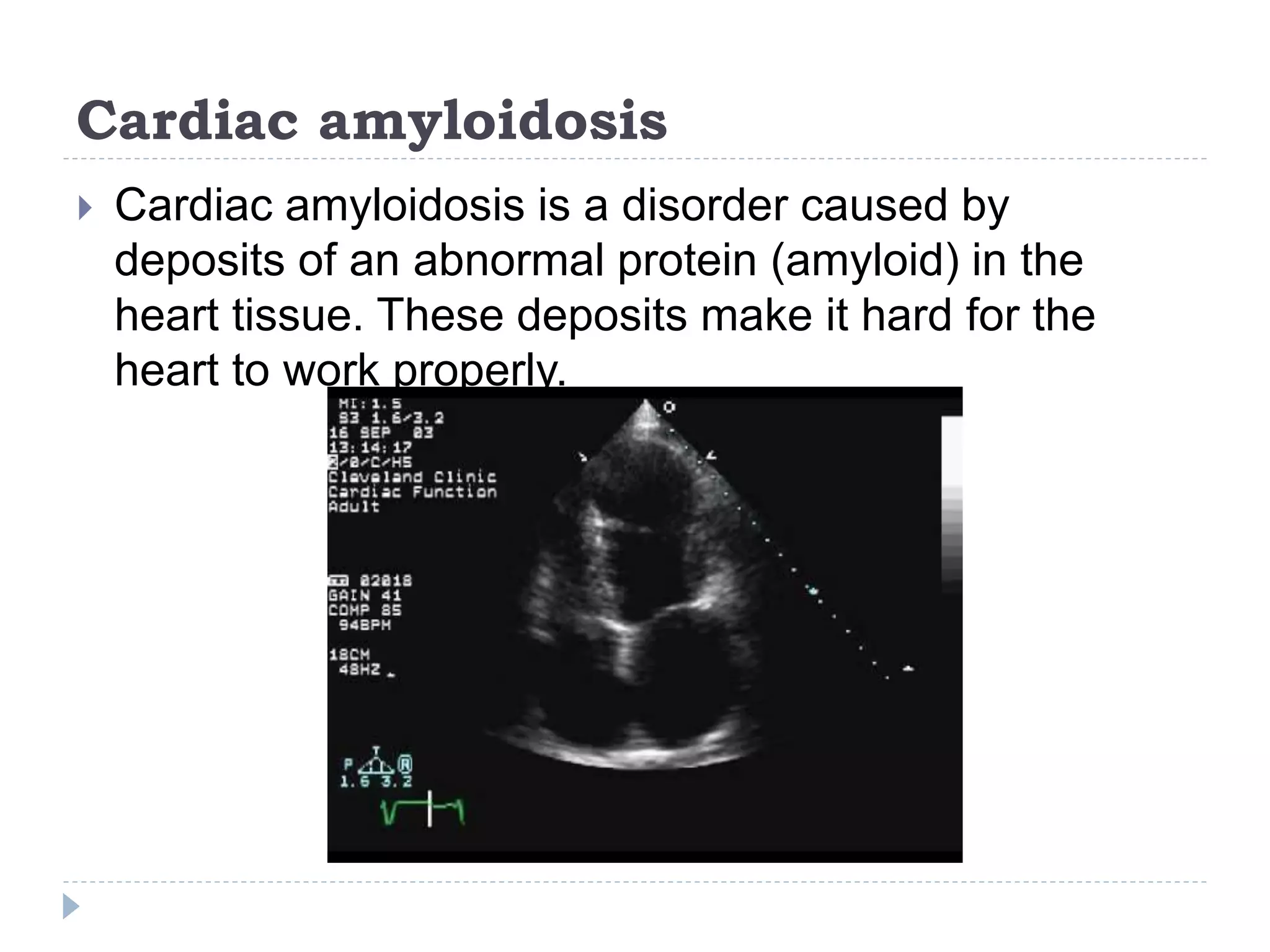 Echocardiogram | PPTX