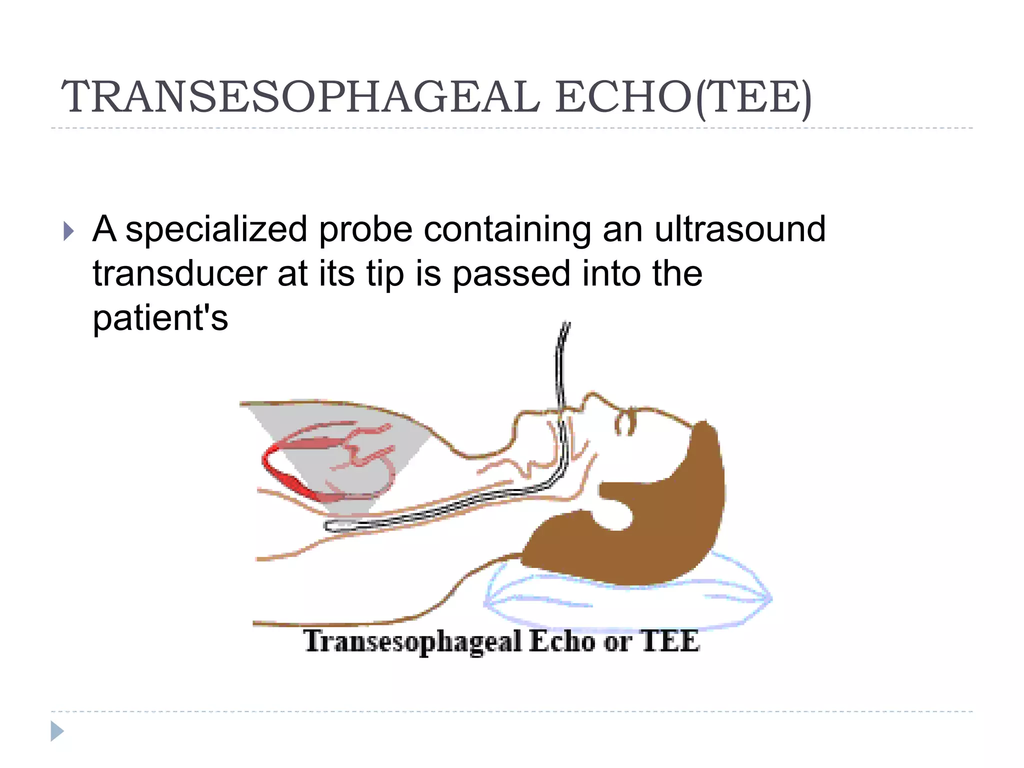 Echocardiogram | PPTX