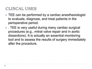 Echocardiogram | PPTX